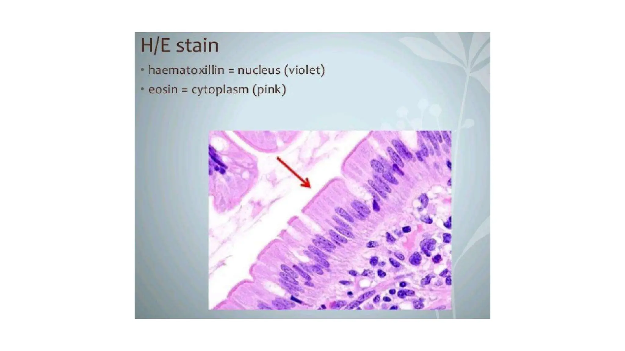Stains and staining procedures in Pathology pptx | PPT