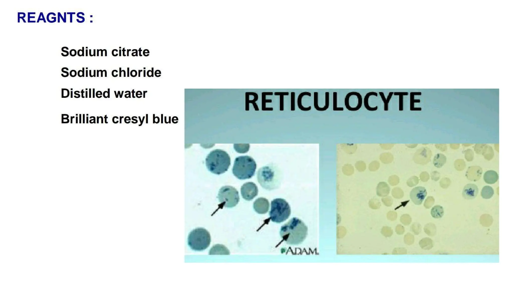 Stains and staining procedures in Pathology pptx | PPT