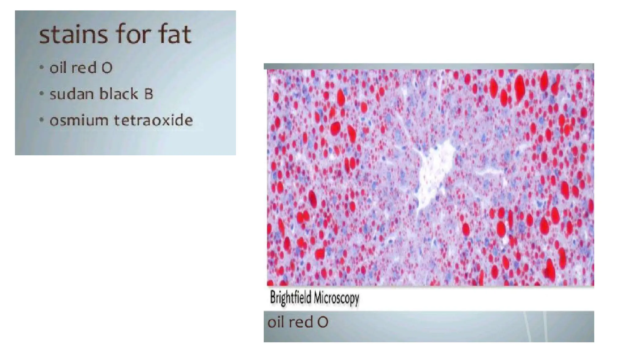 Stains and staining procedures in Pathology pptx | PPT
