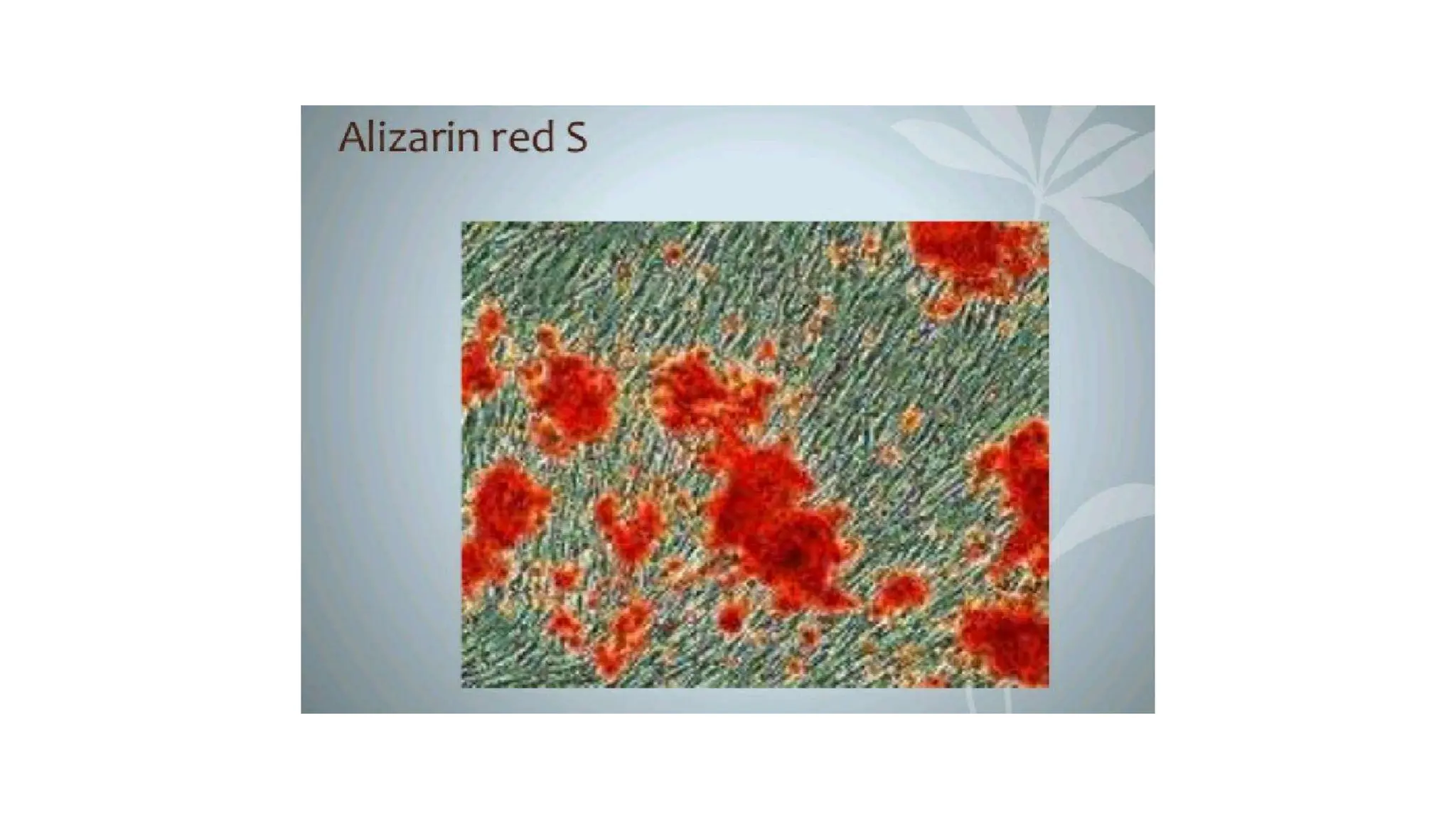 Stains and staining procedures in Pathology pptx | PPT