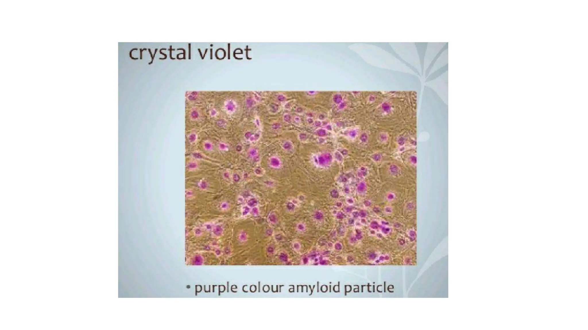 Stains and staining procedures in Pathology pptx | PPT