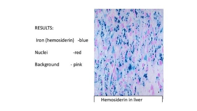 Stains and staining procedures in Pathology pptx | PPT