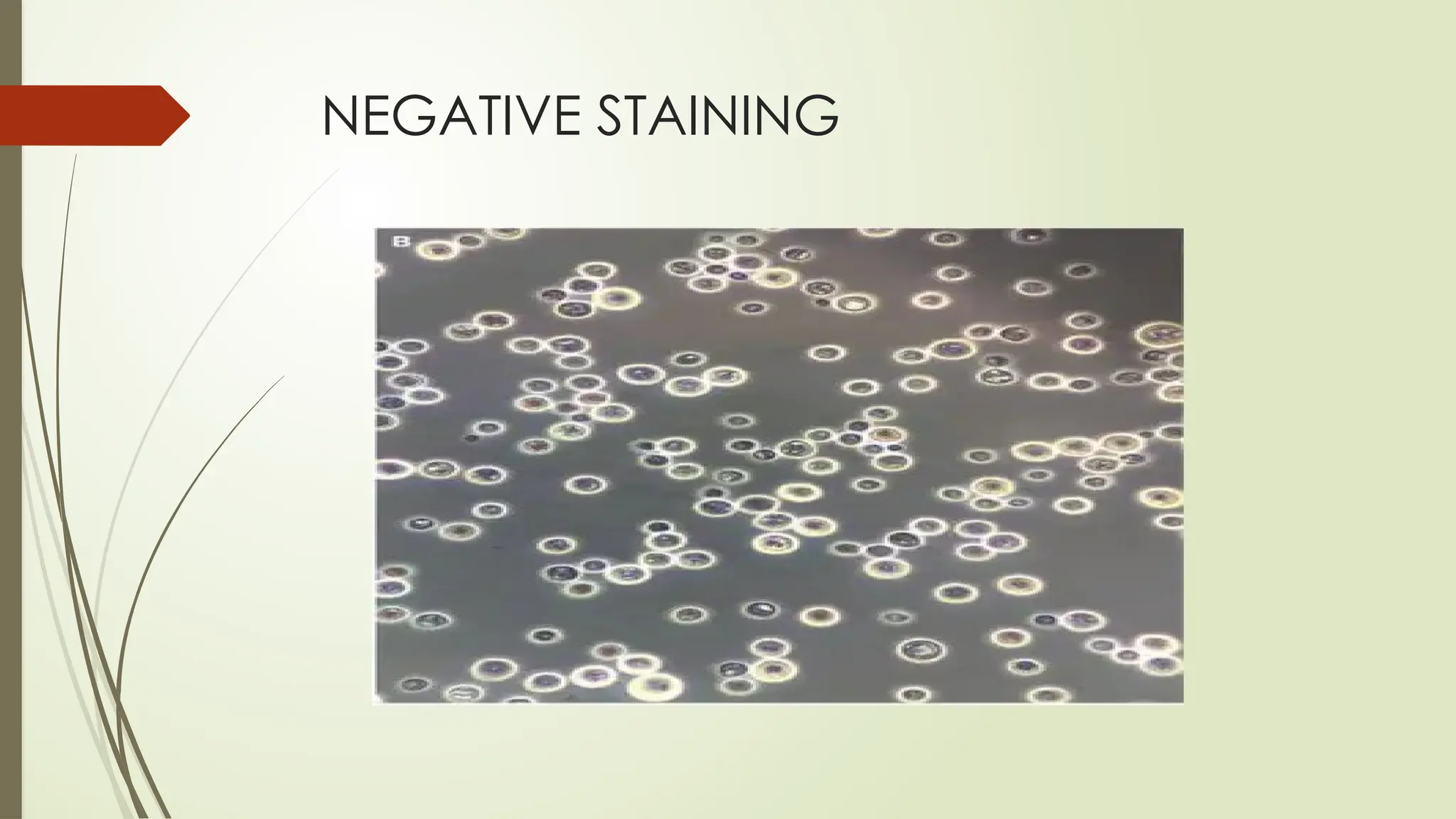 IMPORTANCE OF STUDYING MICROBIOLOGY IN MEDICAL LABORATORY STUDENTS ...