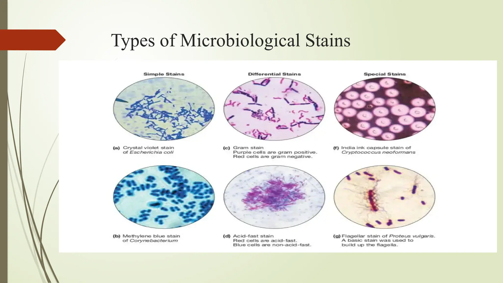 IMPORTANCE OF STUDYING MICROBIOLOGY IN MEDICAL LABORATORY STUDENTS ...