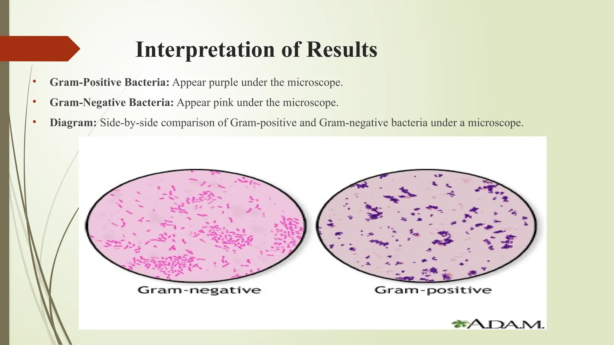 IMPORTANCE OF STUDYING MICROBIOLOGY IN MEDICAL LABORATORY STUDENTS ...