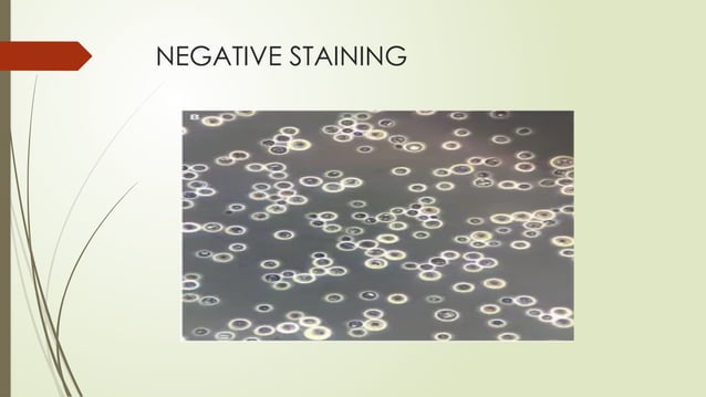 IMPORTANCE OF STUDYING MICROBIOLOGY IN MEDICAL LABORATORY STUDENTS ...