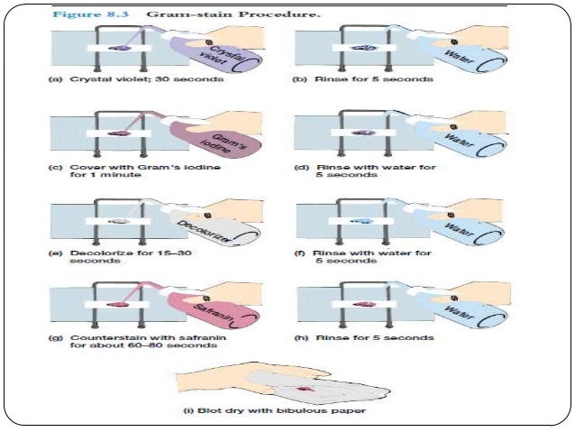 Why Do We Heat Fix The Smear Before Staining It