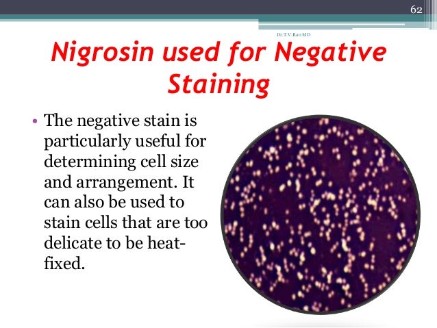 Stainingbacteria 101004225924-phpapp02