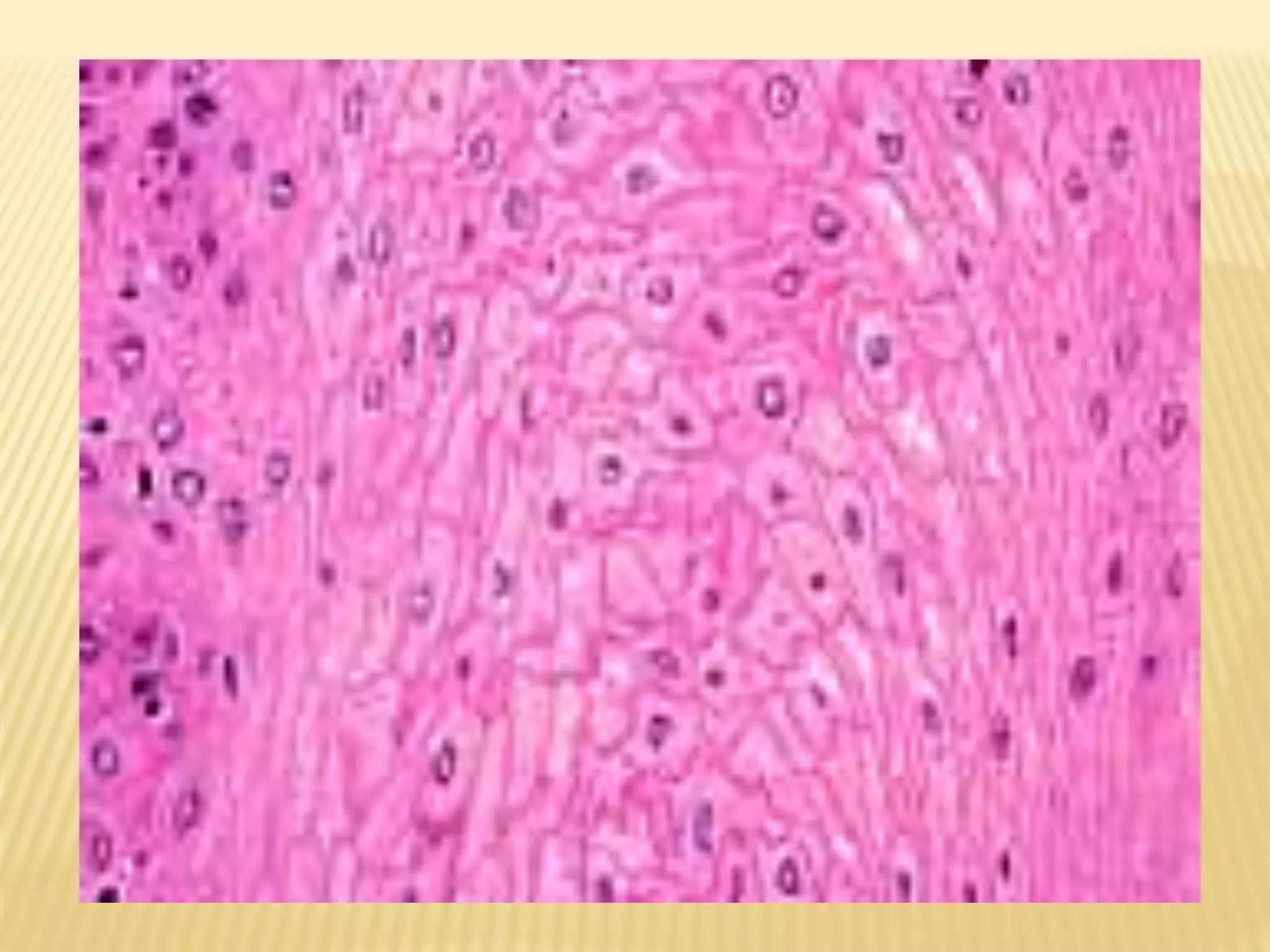 Staining by hematoxylin and eosin | PPTX