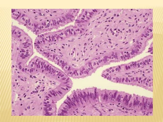 Staining by hematoxylin and eosin | PPT