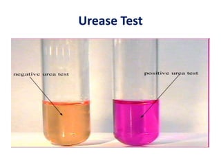Staining & culture medias | PPTX