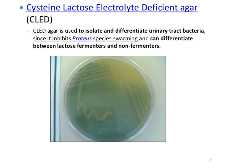 Cystine lactose electrolyte deficient agar - Alchetron, the free social ...
