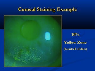 Staining grid lecture | PPT