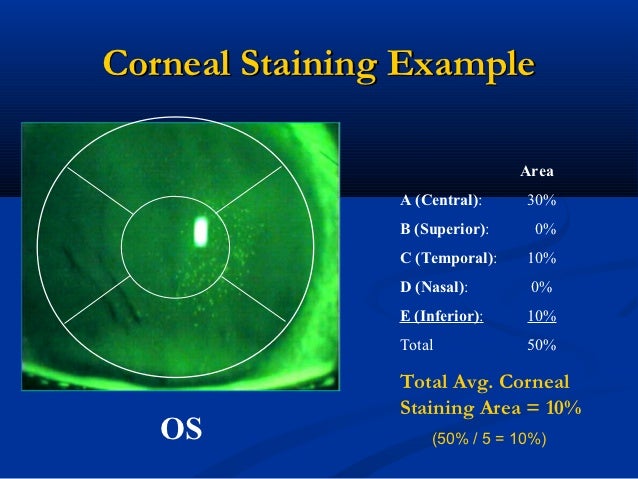 Staining grid lecture