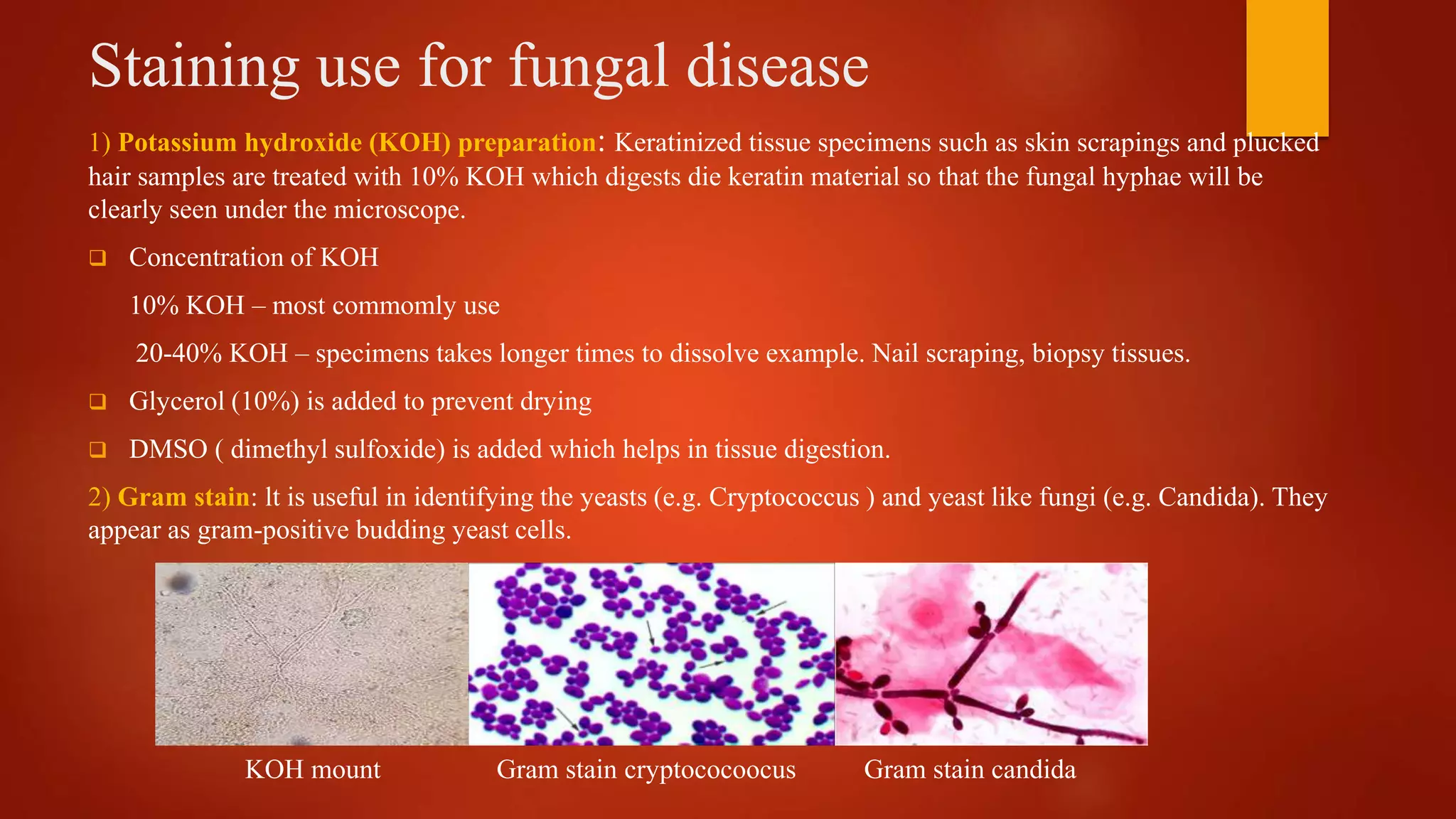 Staining in Microbiology | PPTX