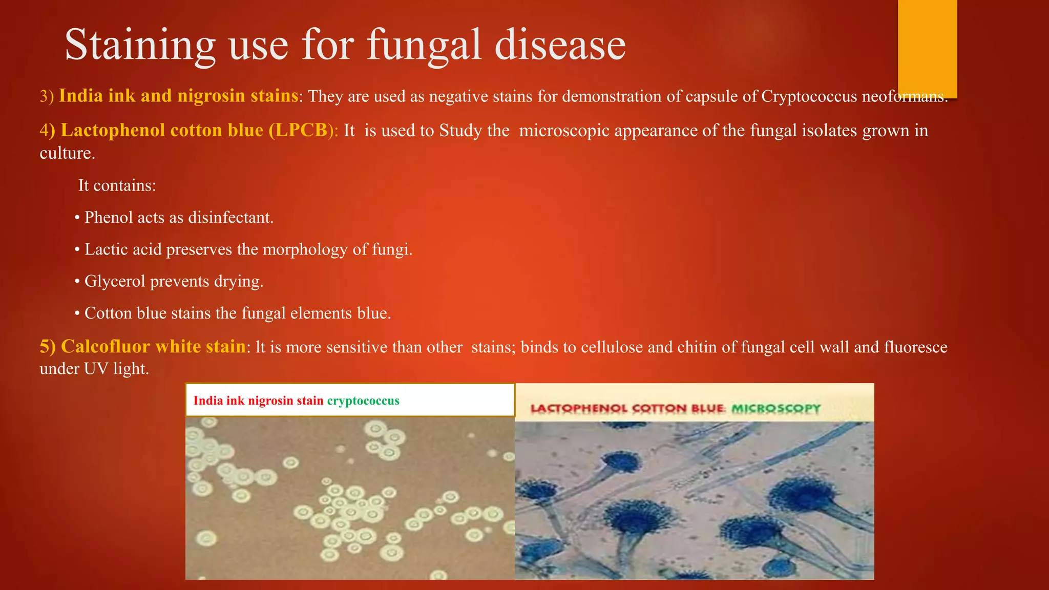 Staining in Microbiology | PPTX