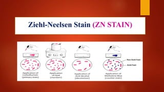 Staining in Microbiology | PPTX