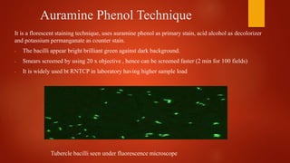 Staining in Microbiology | PPTX