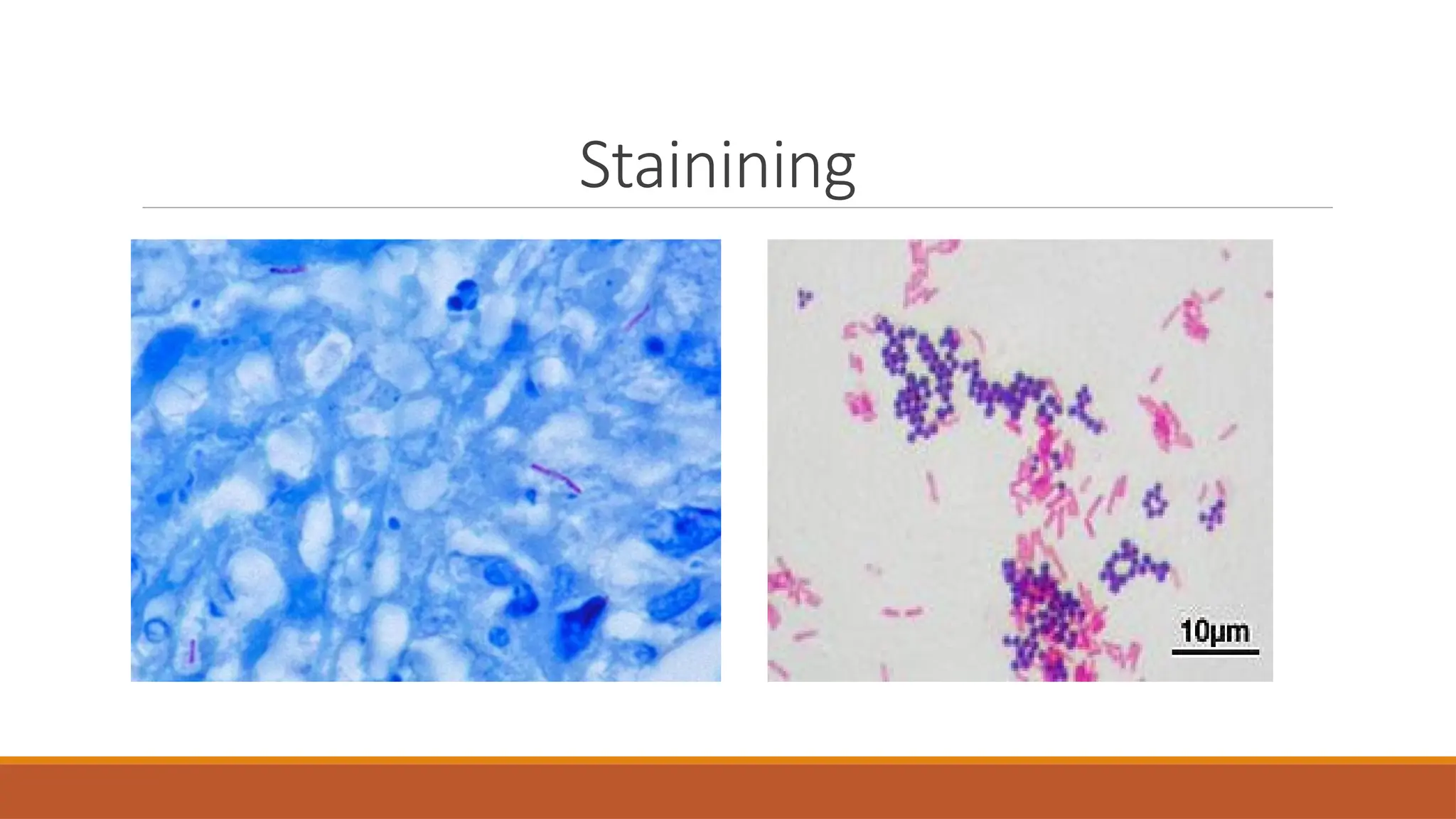 staining micobiology including procedure of gram staining and materials ...