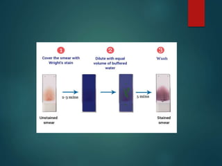 staining of blood smears.pptx