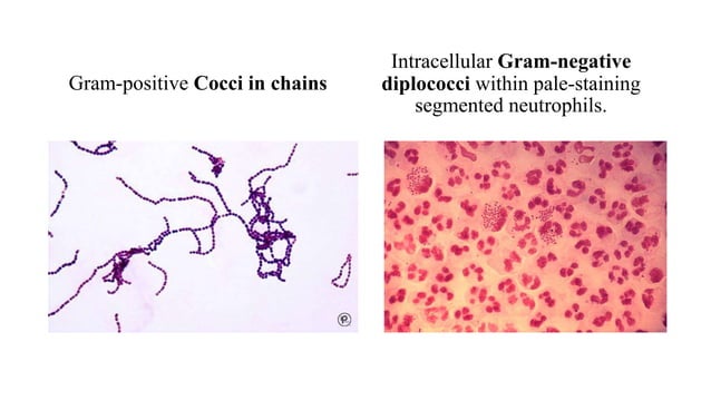 Staining of microorganisms | PPTX