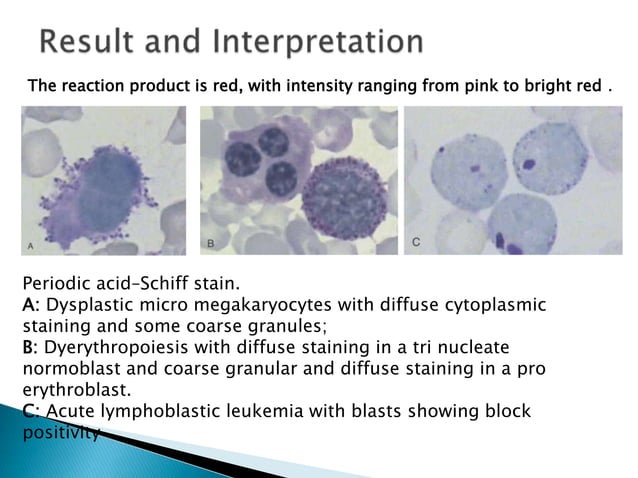 Staining ( rouine and special in cytology) rajiv kumar | PPTX | Blood ...