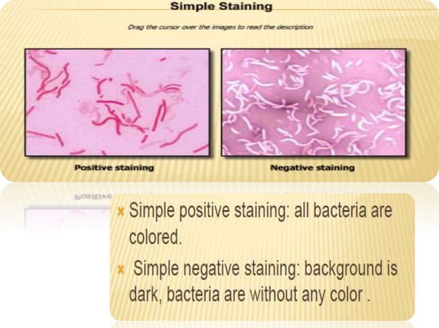 Staining techniques | PPT