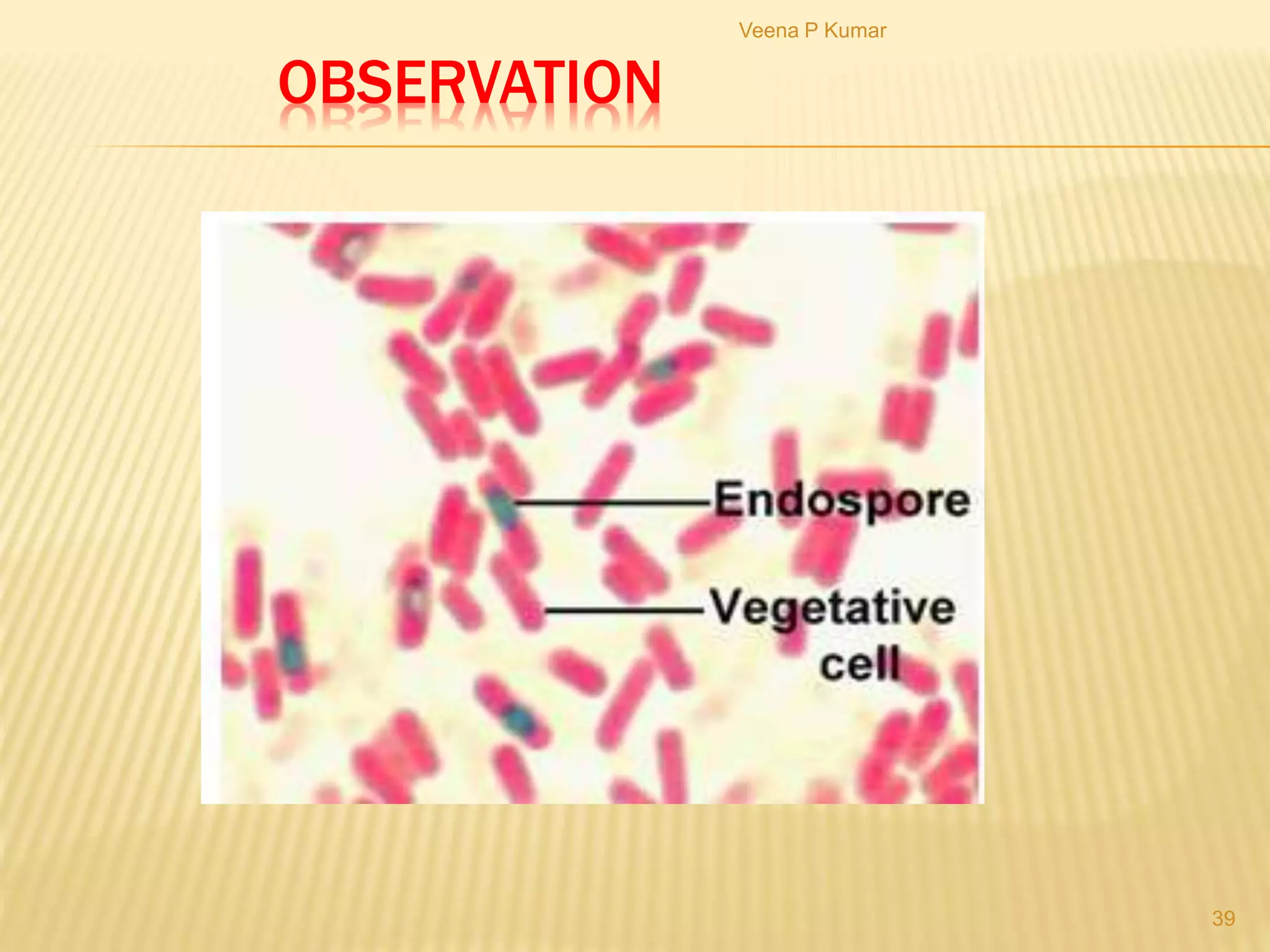 Staining techniques bacteria... | PPTX
