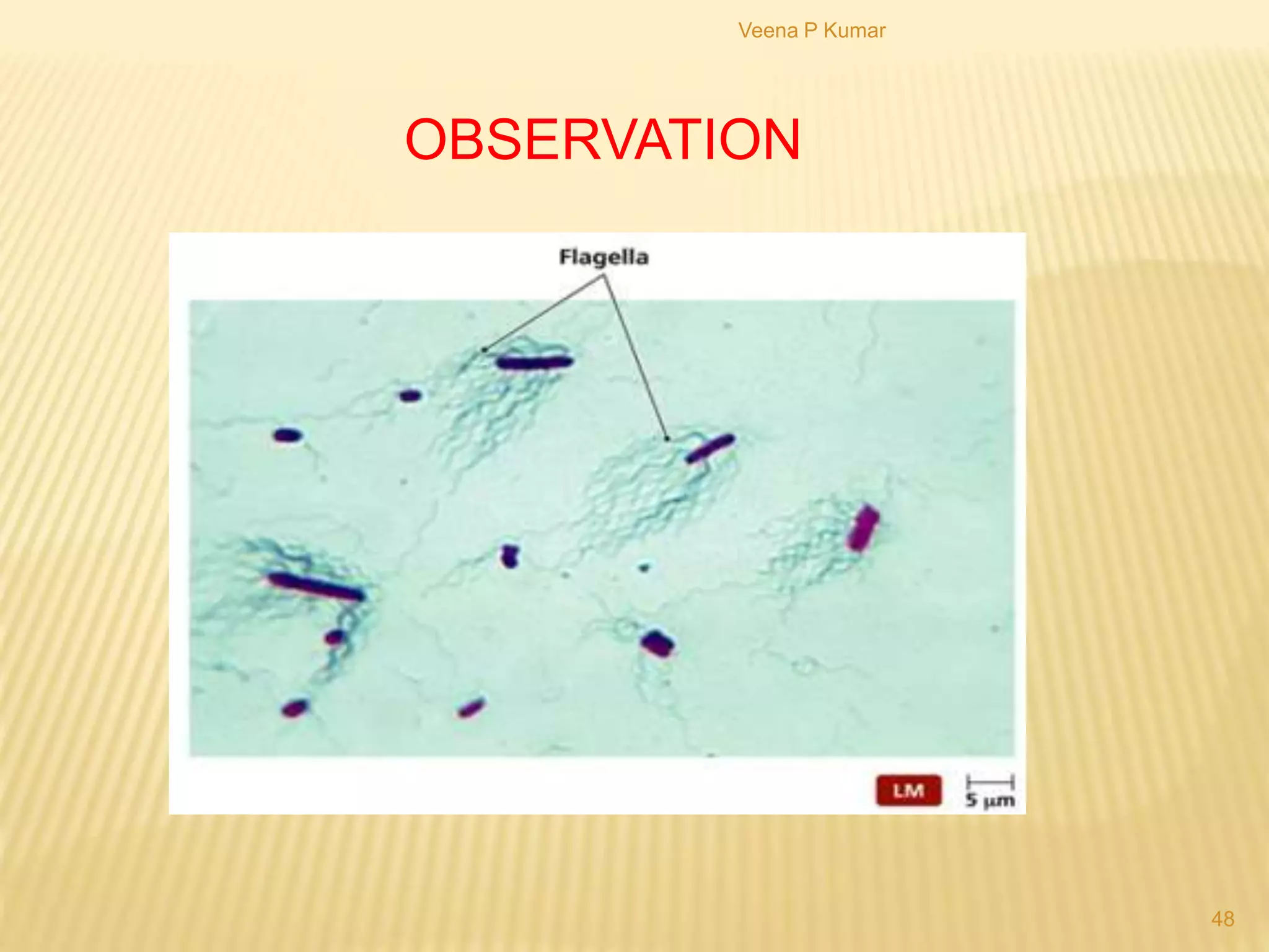 Staining techniques bacteria... | PPTX