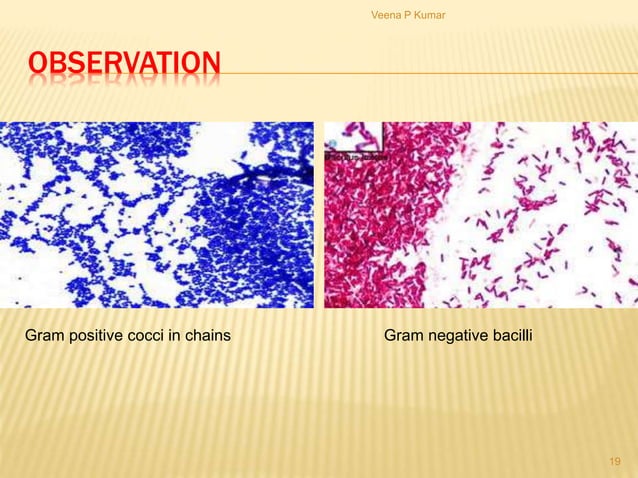 Staining techniques bacteria... | PPTX