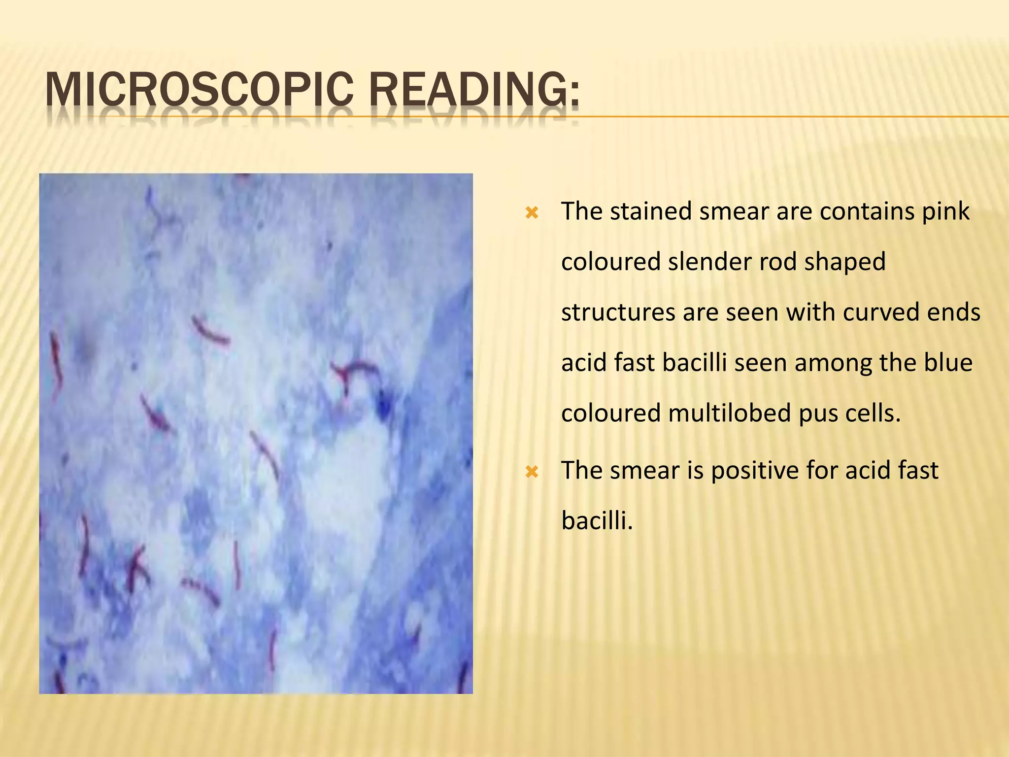 Staining Techniques in Microbiology | PPTX