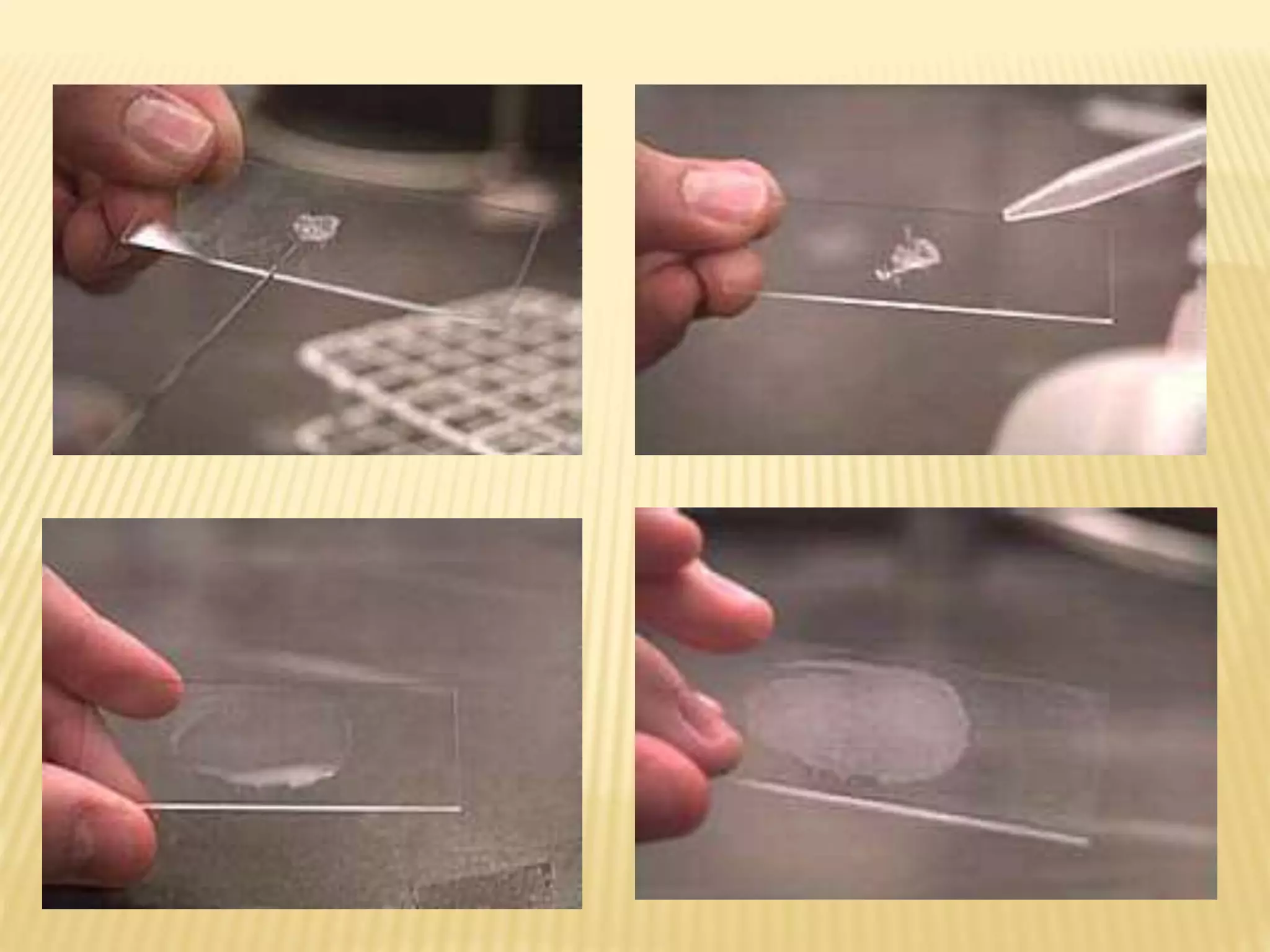 Staining Techniques in Microbiology | PPTX