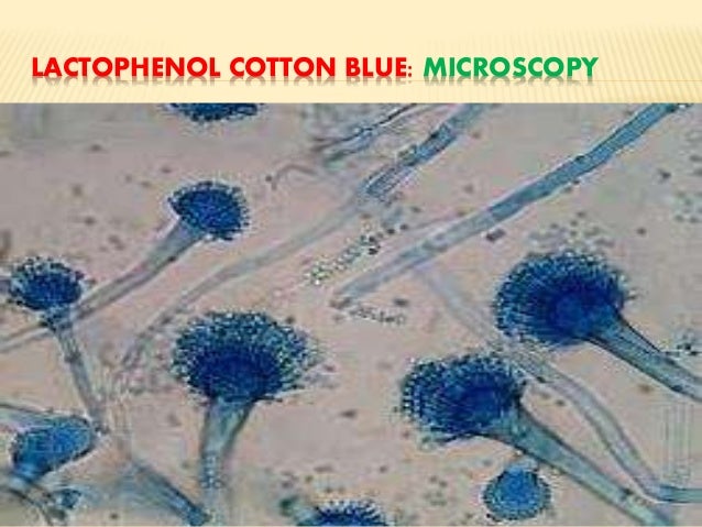 Lecture 1 Microscopy Morphology Smears Stains Fungi