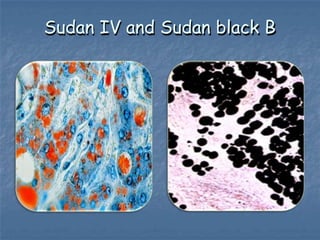 staininng of lipid.pptx