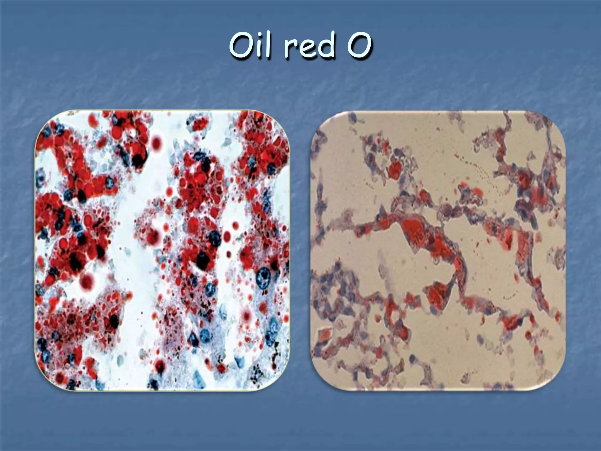 staininng of lipid.pptx