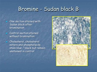 staininng of lipid.pptx