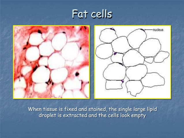 staininng of lipid.pptx