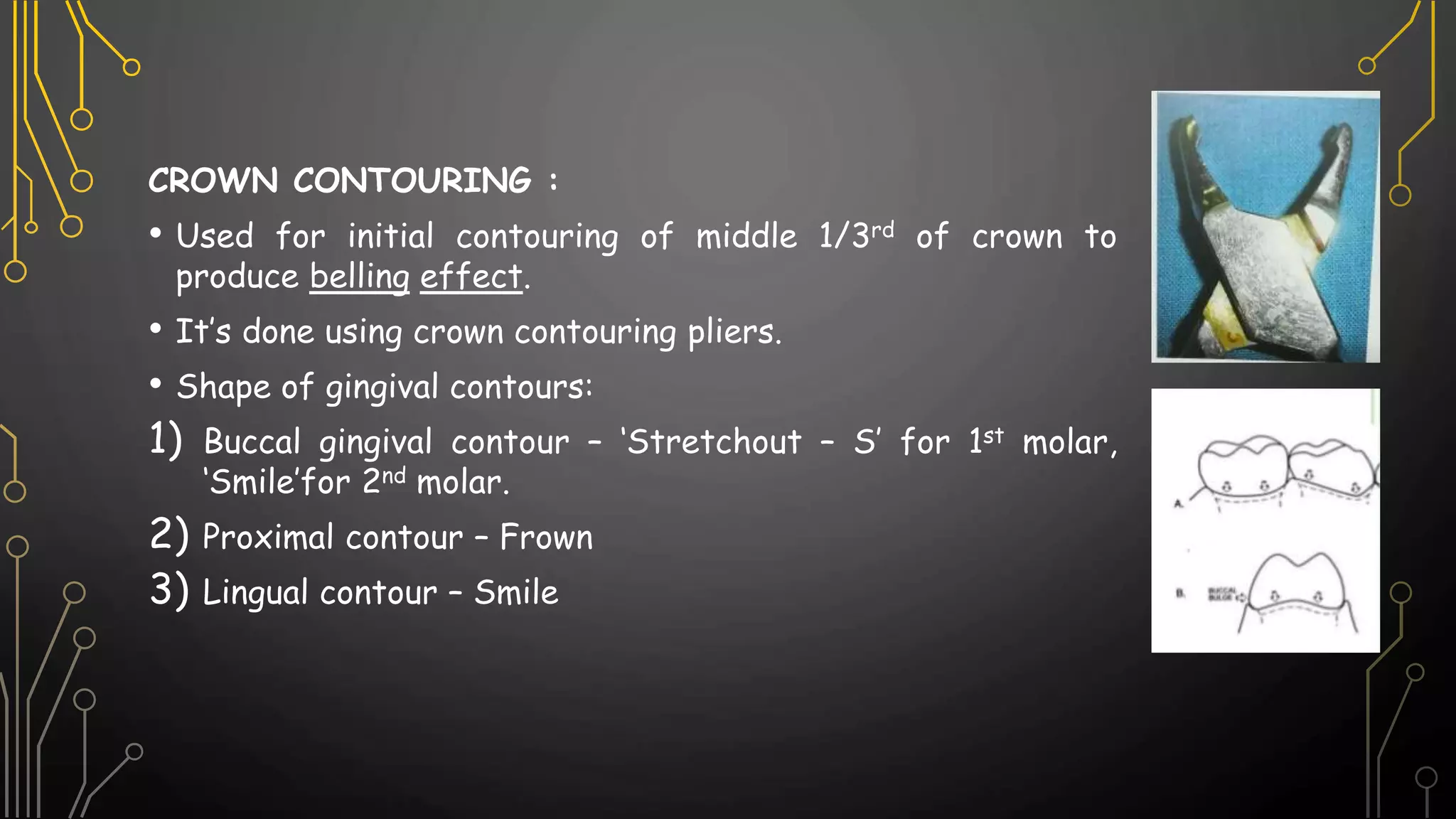 Stainless steel crown | PPTX