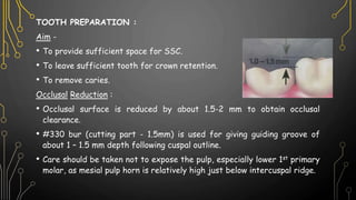 Stainless steel crown | PPTX