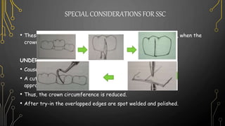 Stainless steel crown | PPTX