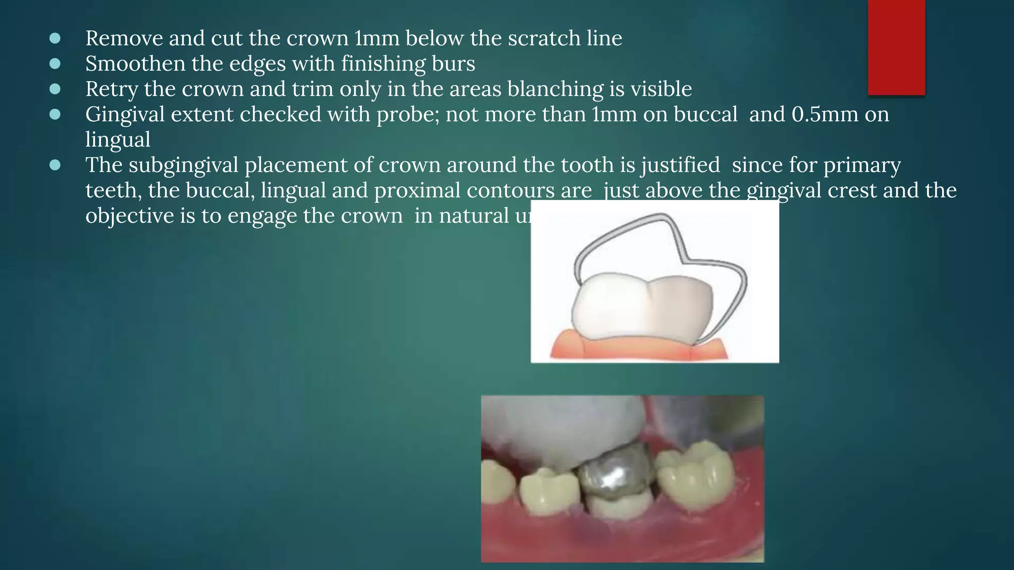STAINLESS STEEL CROWN.pptx
