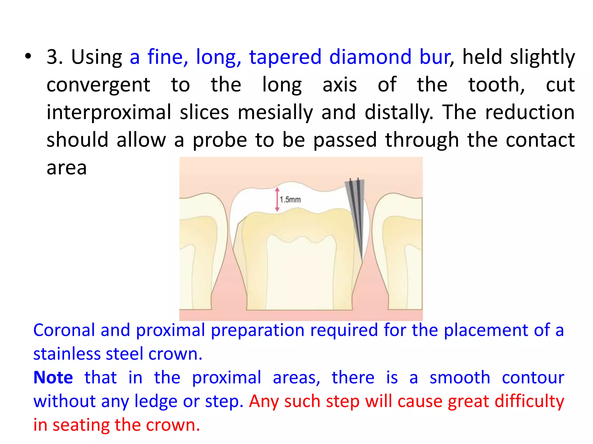 Stainless steel crown .pptx