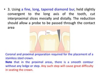 Stainless steel crown .pptx