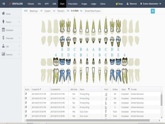 Stainless steel crowns