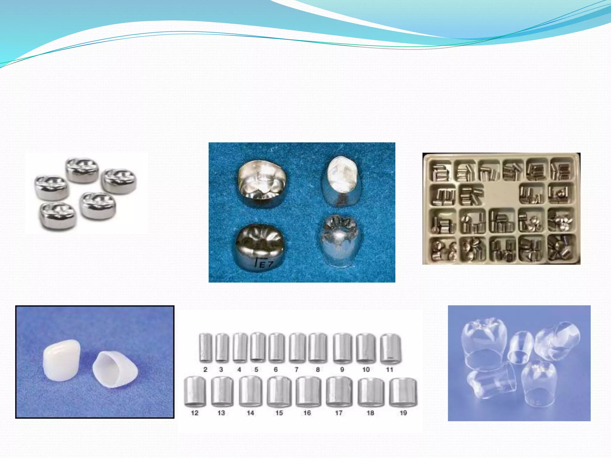 Stainless steel crowns | PPTX