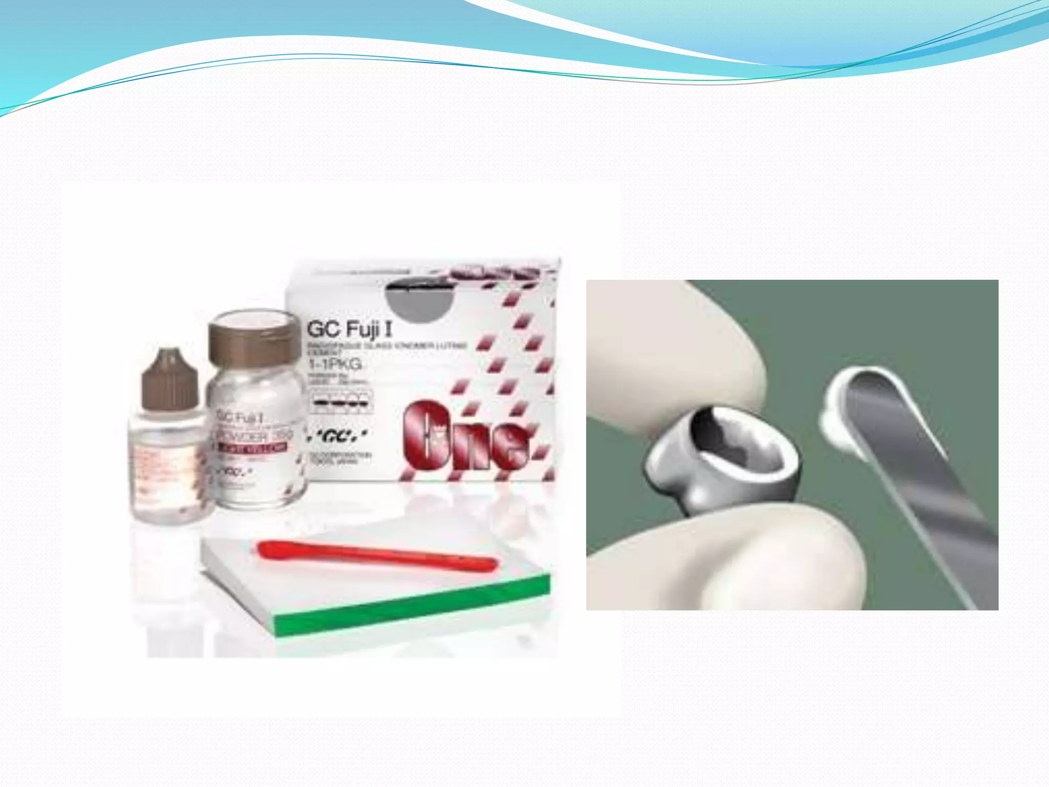 Stainless steel crowns | PPTX