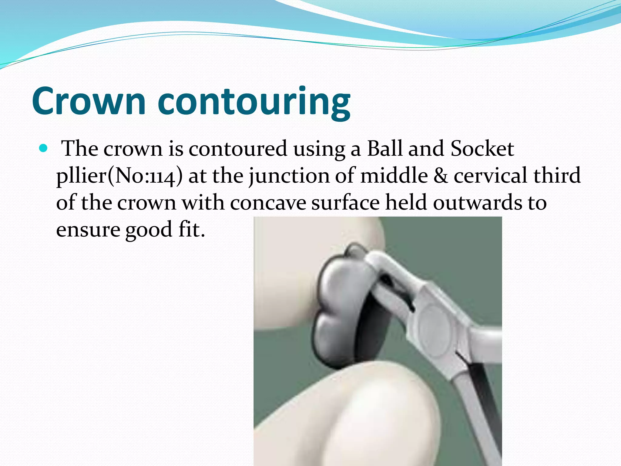 Stainless steel crowns | PPTX