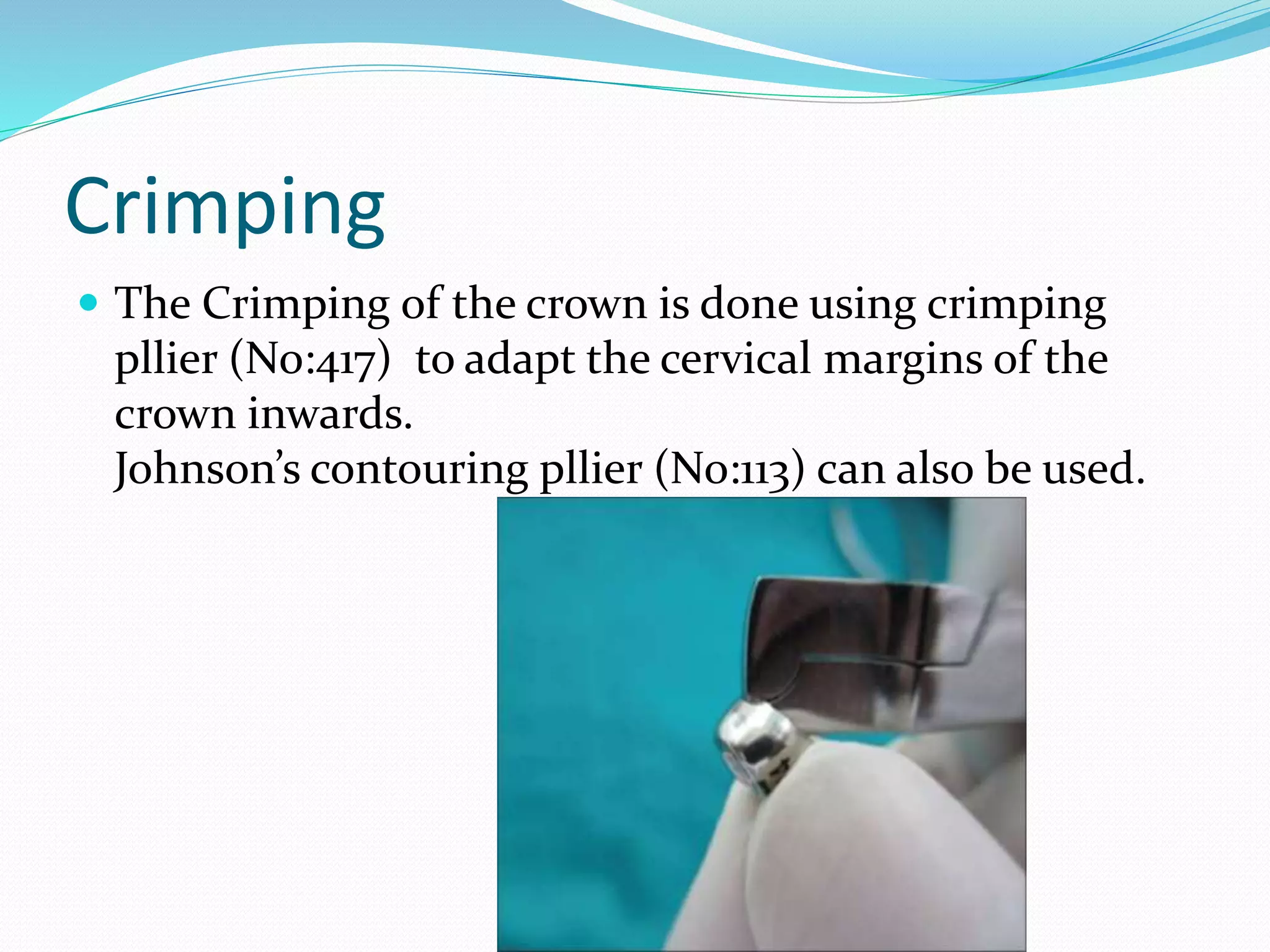 Stainless steel crowns | PPTX