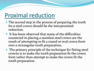 Stainless steel crowns | PPTX