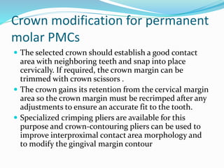 Stainless steel crowns | PPTX